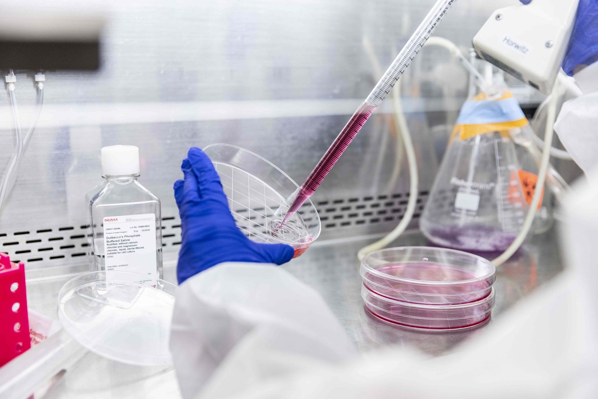 Horwitz Lab - The University of Washington